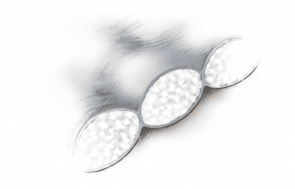 Construction & Fills Defined | DOWN inc.